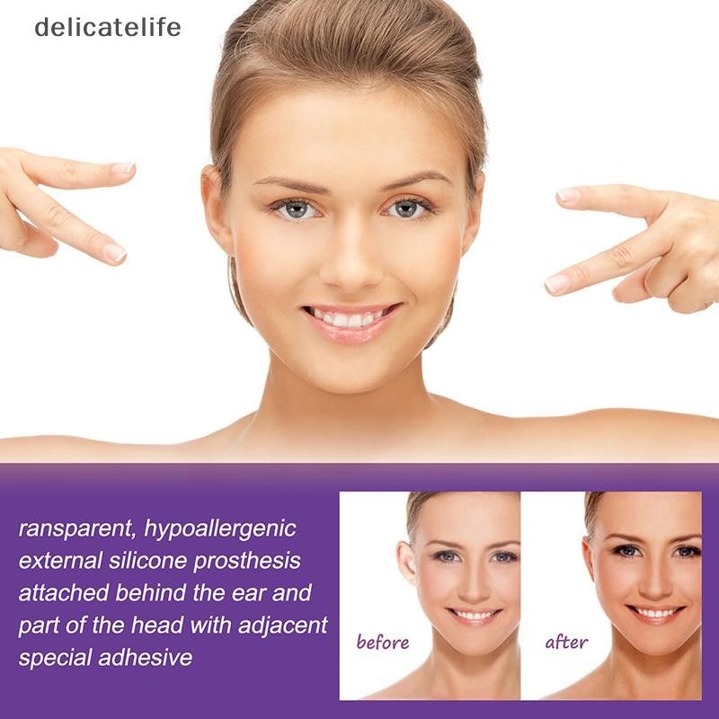 delicatelife 6PCS Ear Stickers Veneer Ears Be Ear Correction Vertical ...