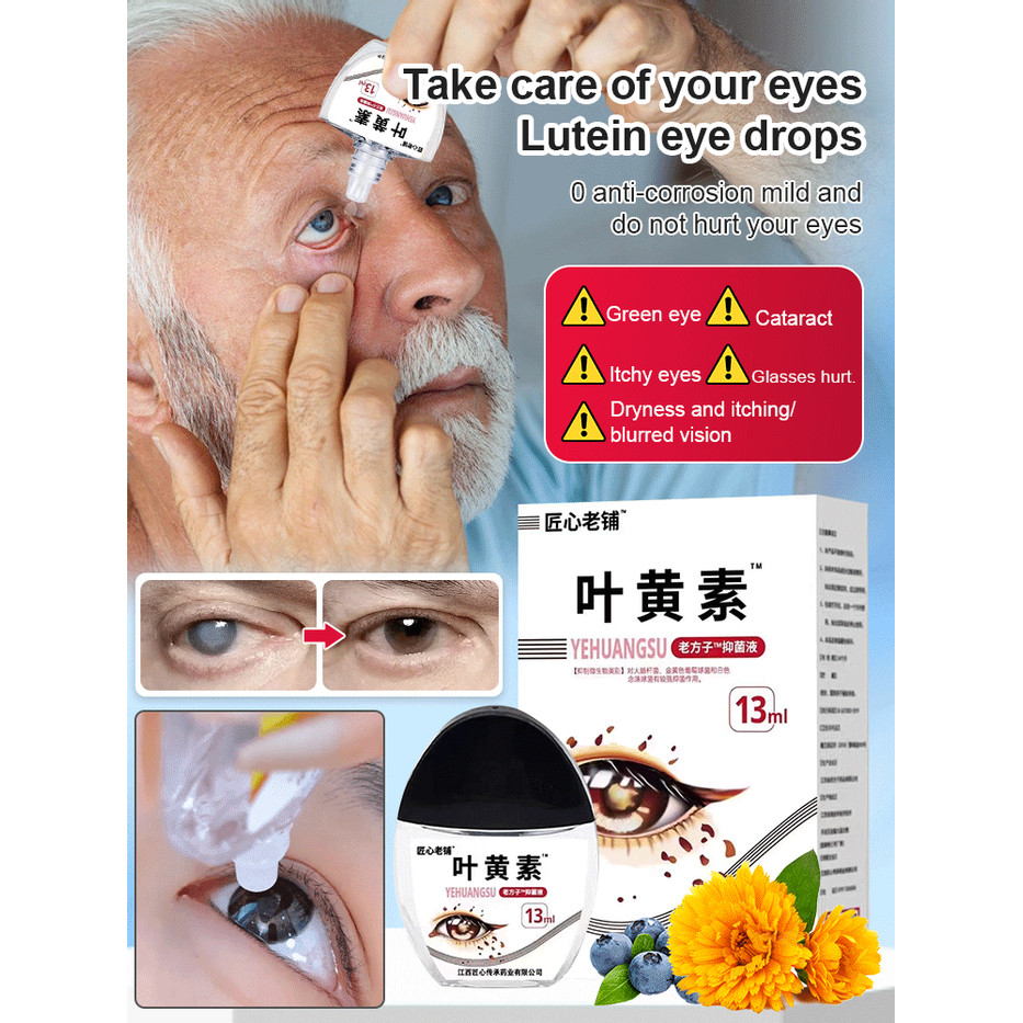 Natural Eye drops Eye liquid loss of vision Relieve eye fatigue ...