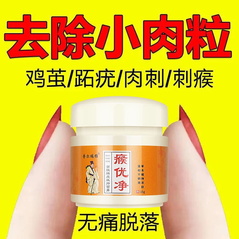 Contact now corncob cream painless scar-free removal of neck skin tags ...