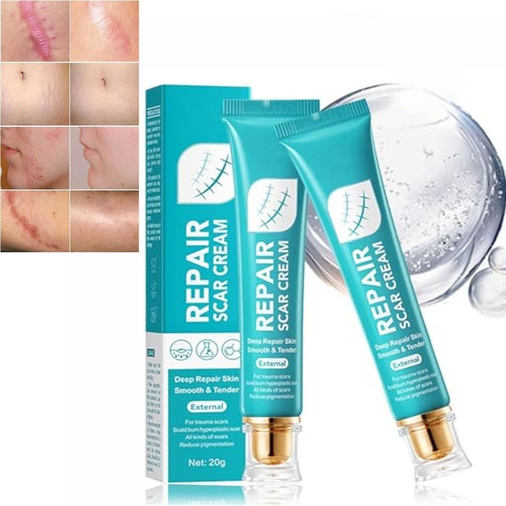 Scar Repair Cream,Repair Scar Cream,Advance Scar Gel,Scar Healing Cream ...