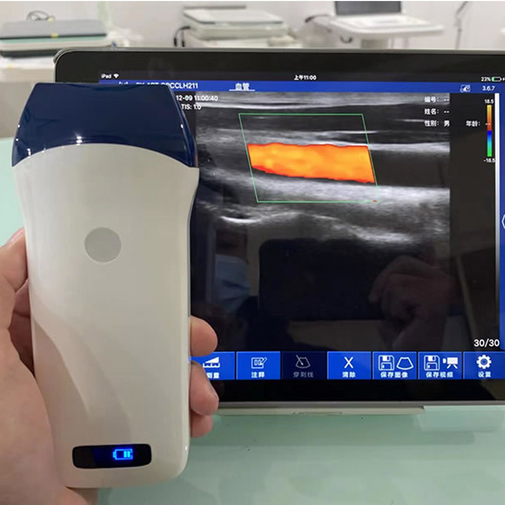CProbe-5L Linear array wireless probe Scanner Portable Machine WIFI ...