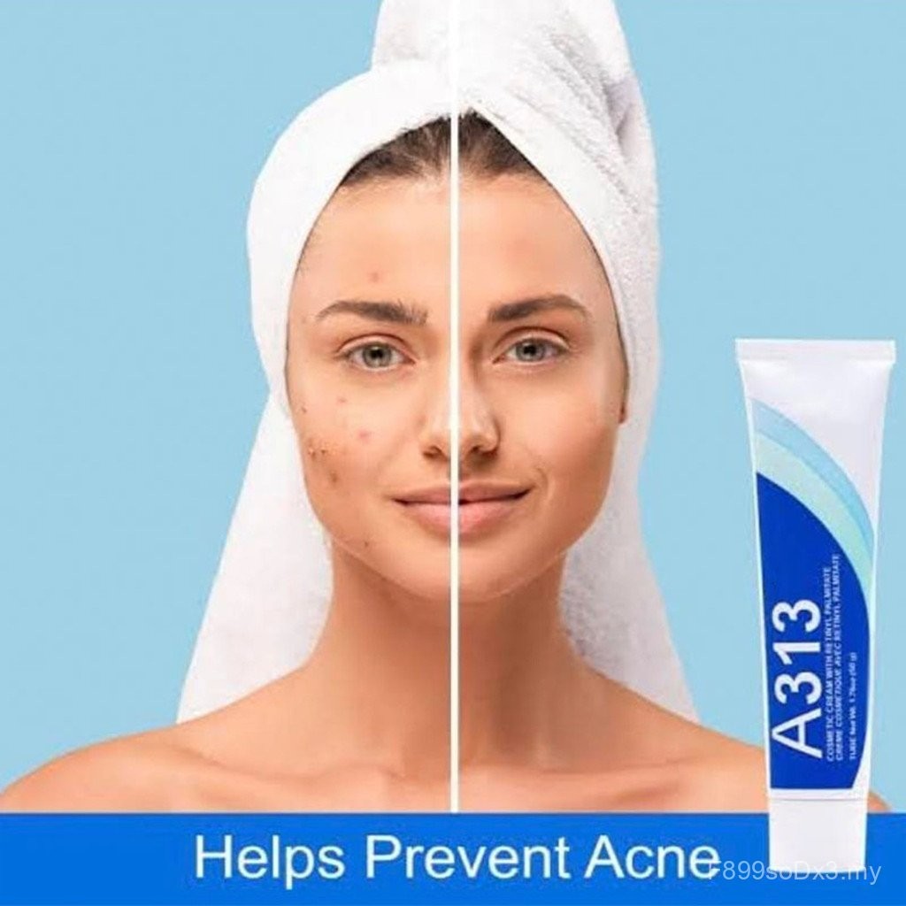 Pembaikan Halangan Tidak Berminyak BARUBT Retinol Vitamin A Krim A313 ...