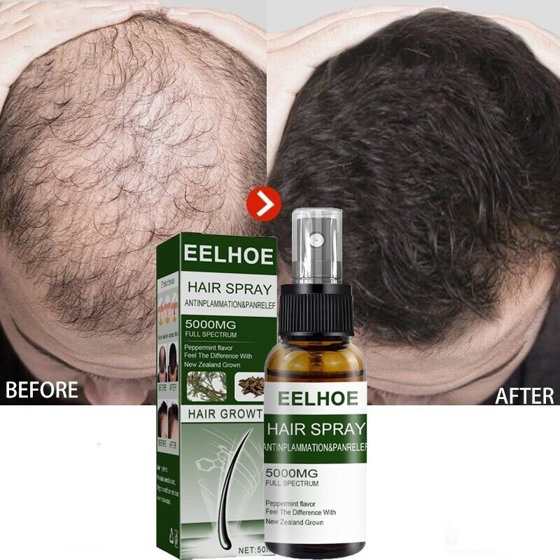 solve hair loss Hair Growth Spray Anti hair Fast Hair Growth Serum ...