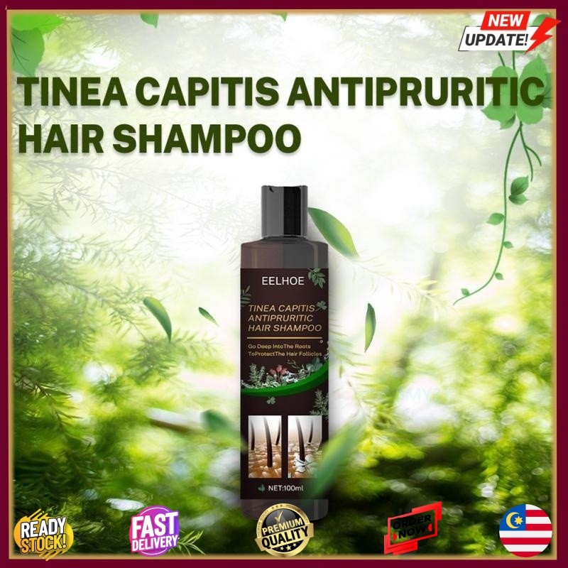 New Anti Itchy Deep Cleansing Tinea Capitis Antipruritic Hair Shampoo ...