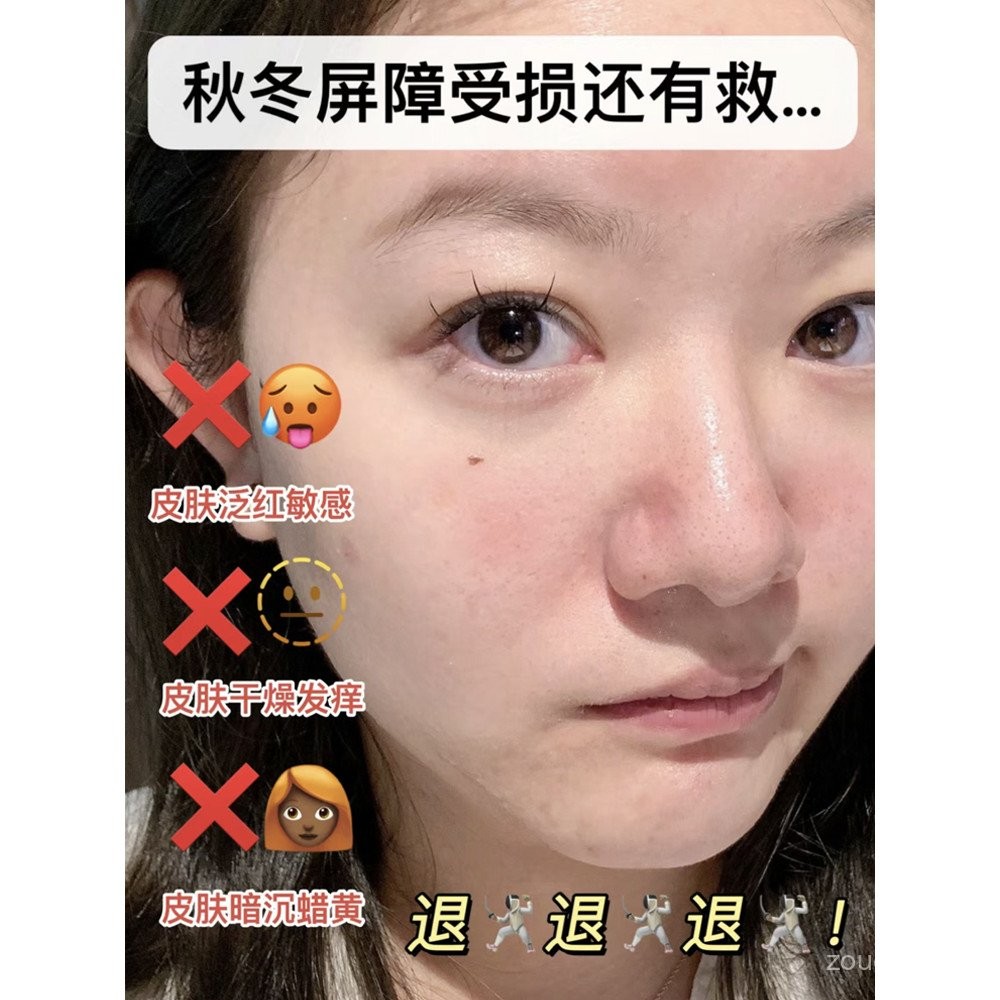Chamomile Soothing pembaikan Toner Mask No. 1 Hot List sensitif Skin ...