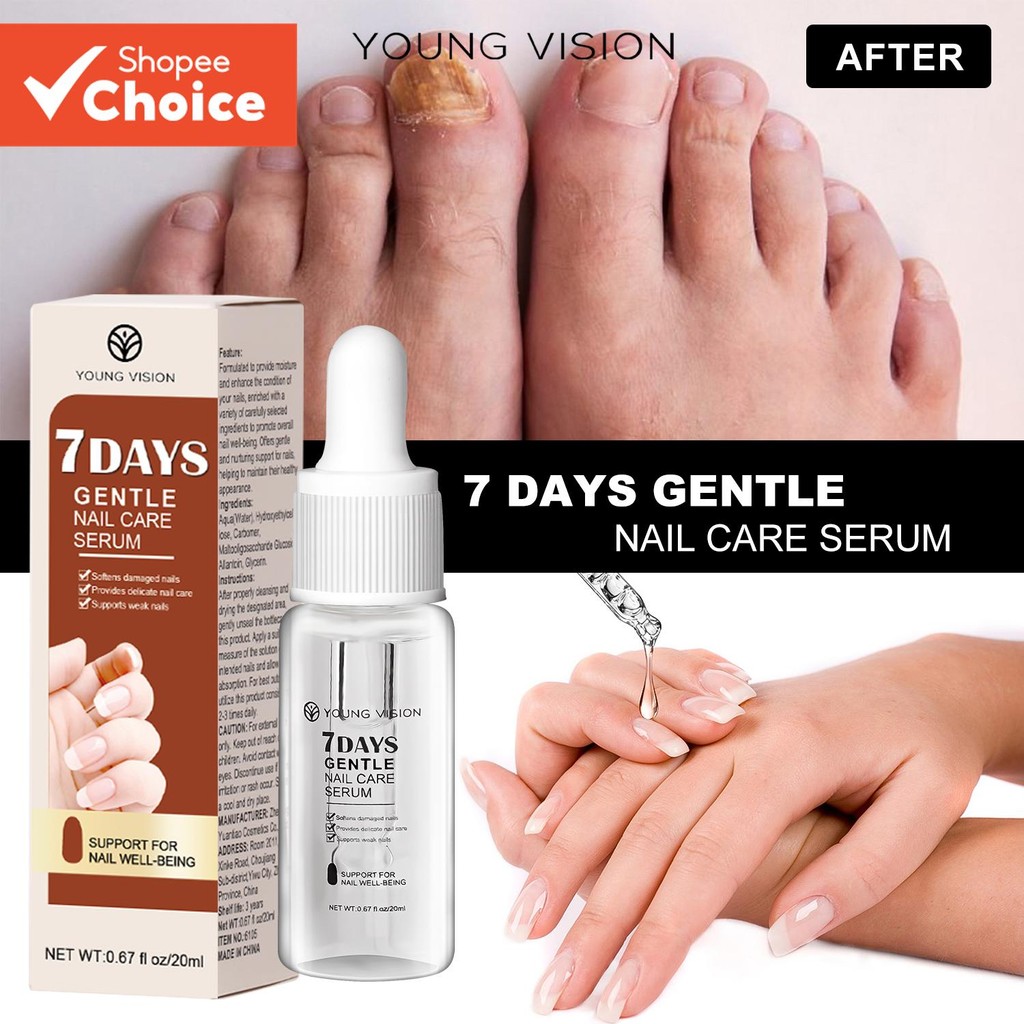 7 Days Gentle Nail Care Essence Essence Care Essence Onychomycosis Hand ...