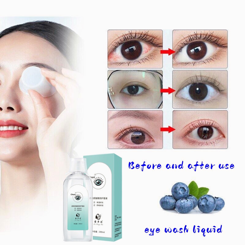 【in stock】Eye Drops for cataract Medical ubat mata rabun Eye Wash dry ...