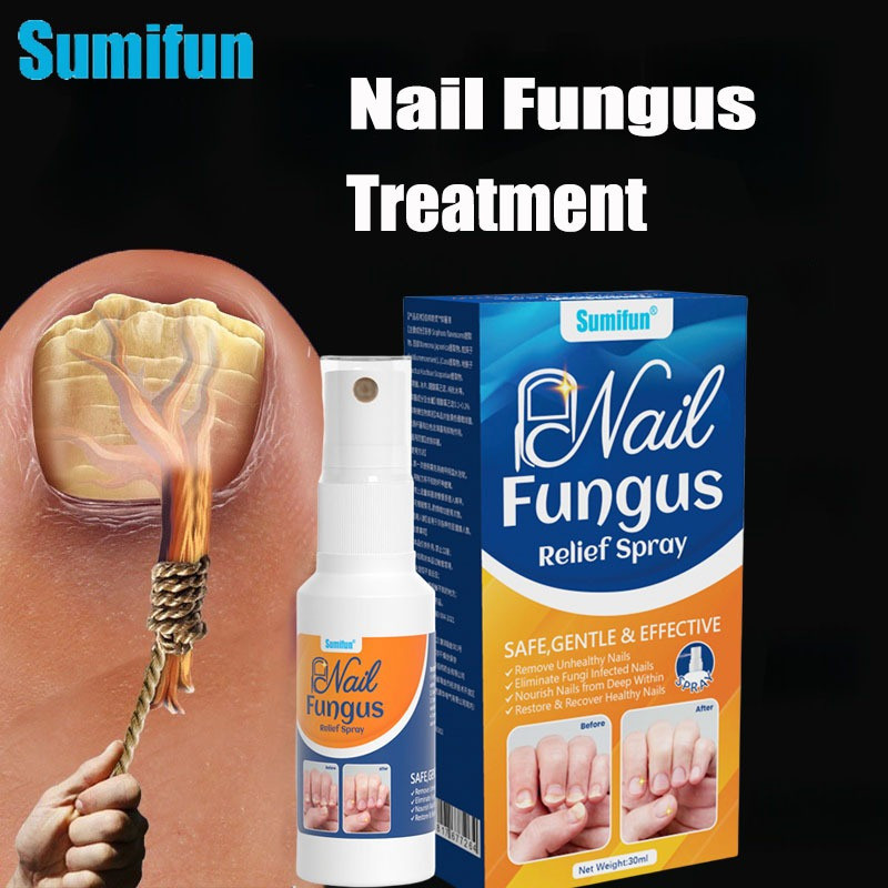 Nail Fungus Treatment Nail Repair Liquid Stop Fungal Growth Effective ...