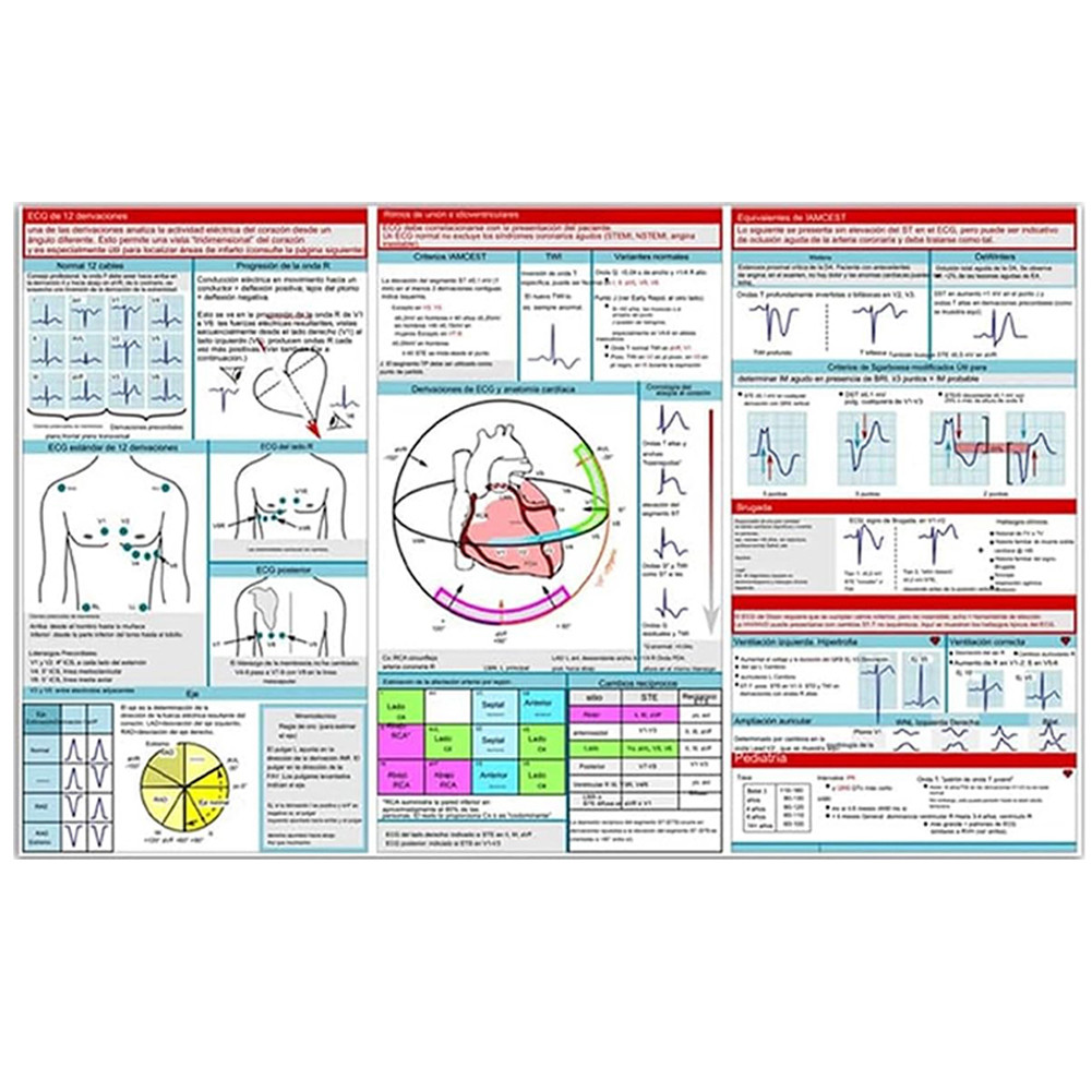 [Redkee.my] EKG Rhythm Interpretation Double Sided Compact Portable Reference Card ECG/EKG ...