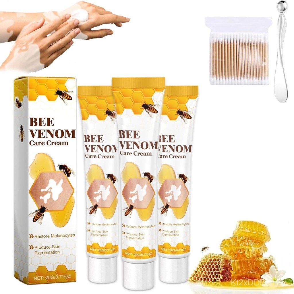 BeeVenom Vitiligo Treatment Cream, Vitigo Bee Venom Treatment Cream ...