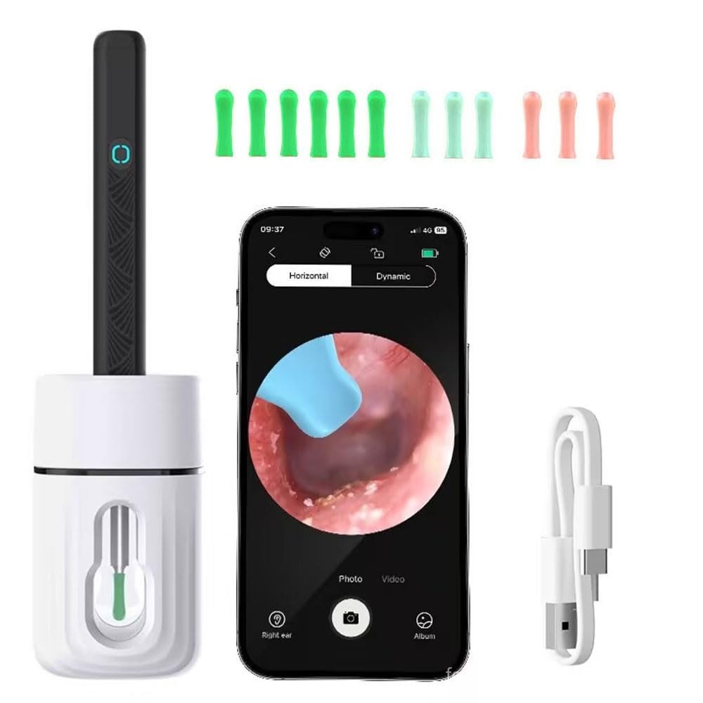 Smart Ear Wax Removal Kit with HD Camera 12 Spoons, NE3 pro wifi visual ...