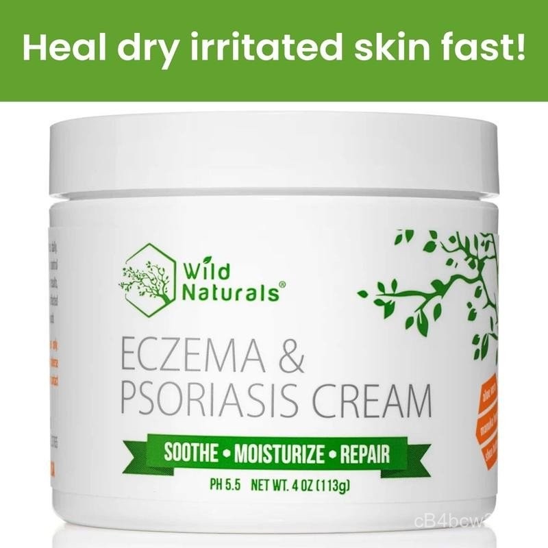 Eczema & Psoriasis Cream - Effective Treatment for Skin Conditions ...