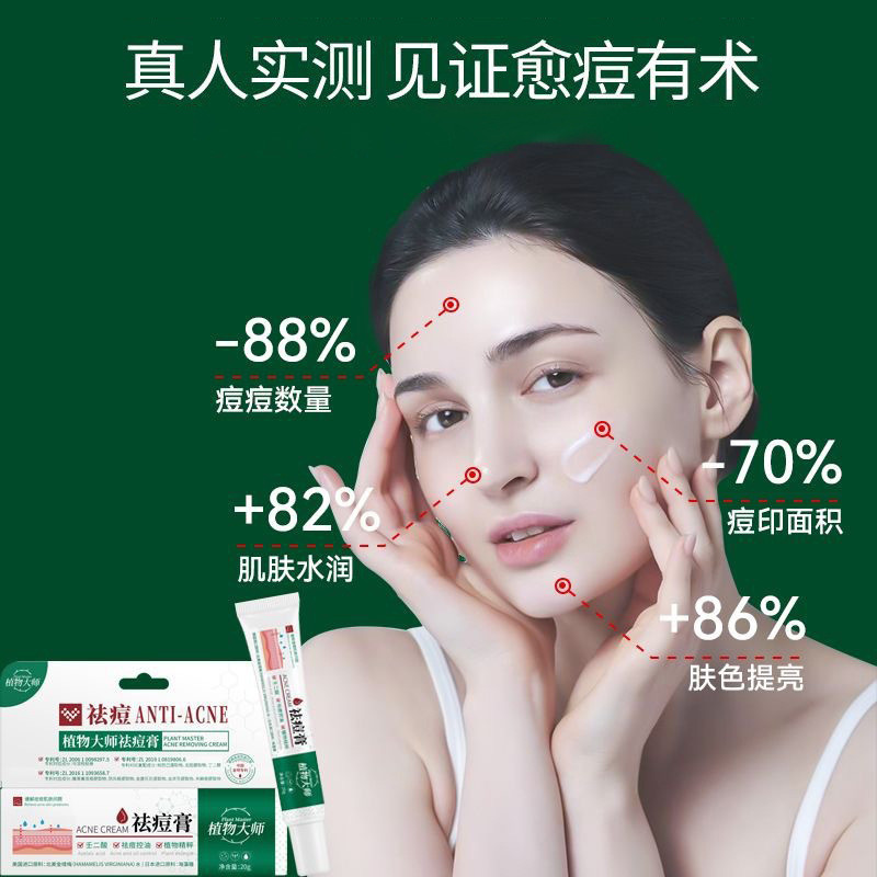 [Preferred Good Things] Plant Master Acne Removal Cream Repair Acne ...