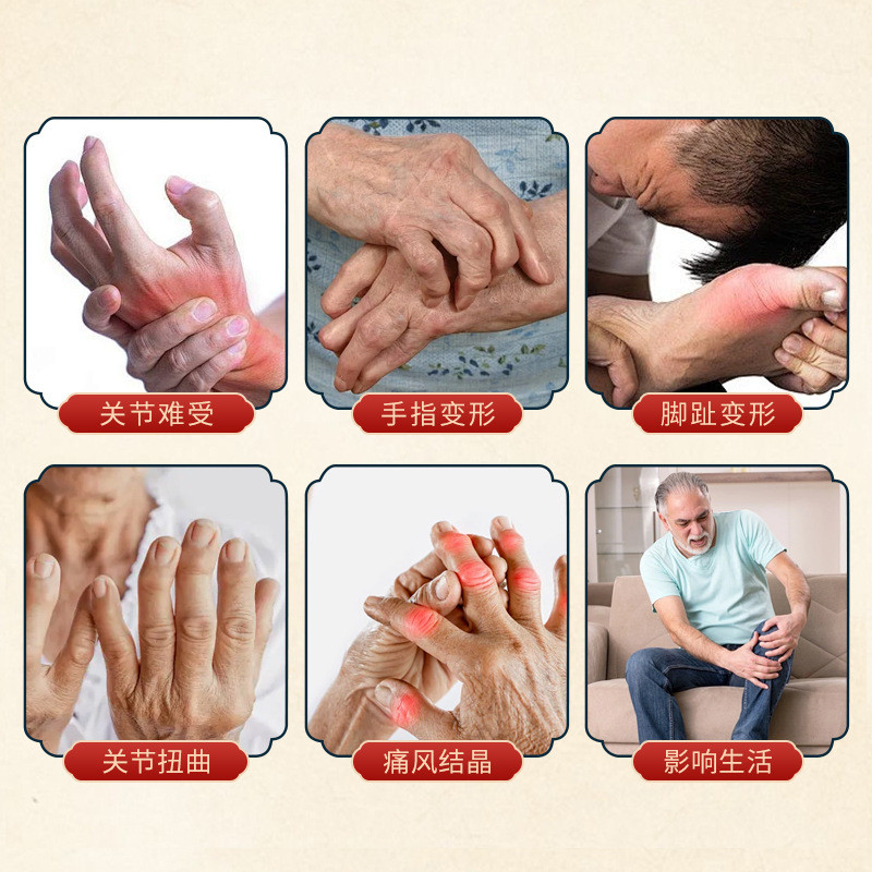 Akito Mikawa Brand Pain Wind Type Acupoint Pressure Stimulation Patch ...