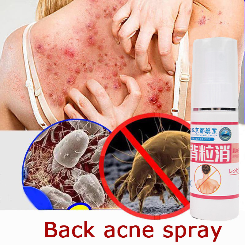 Acne spray back acne spray 60ml antibacterial and anti-inflammatory to ...