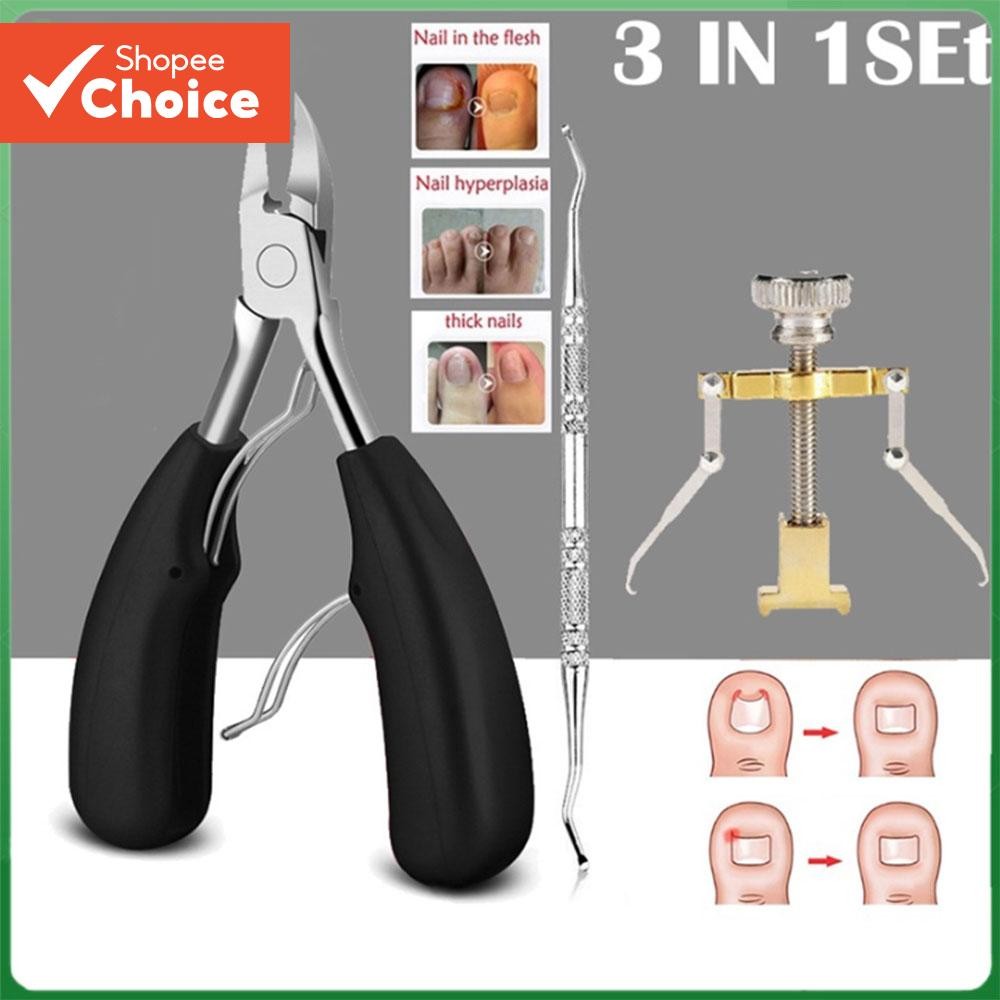Ingrown Toenail Treatment Tool 2/3Pc/Set Corrector Clipper Lifter Kit ...