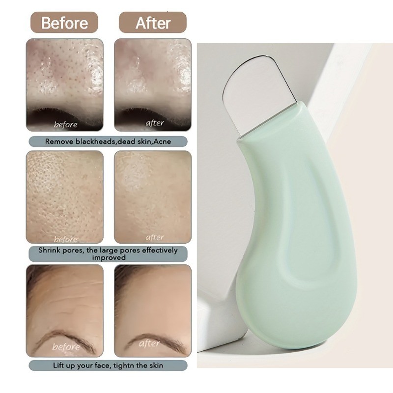 Blackhead Removal Dead Skin Acne Silicone Scraper Facial Hair Follicle ...