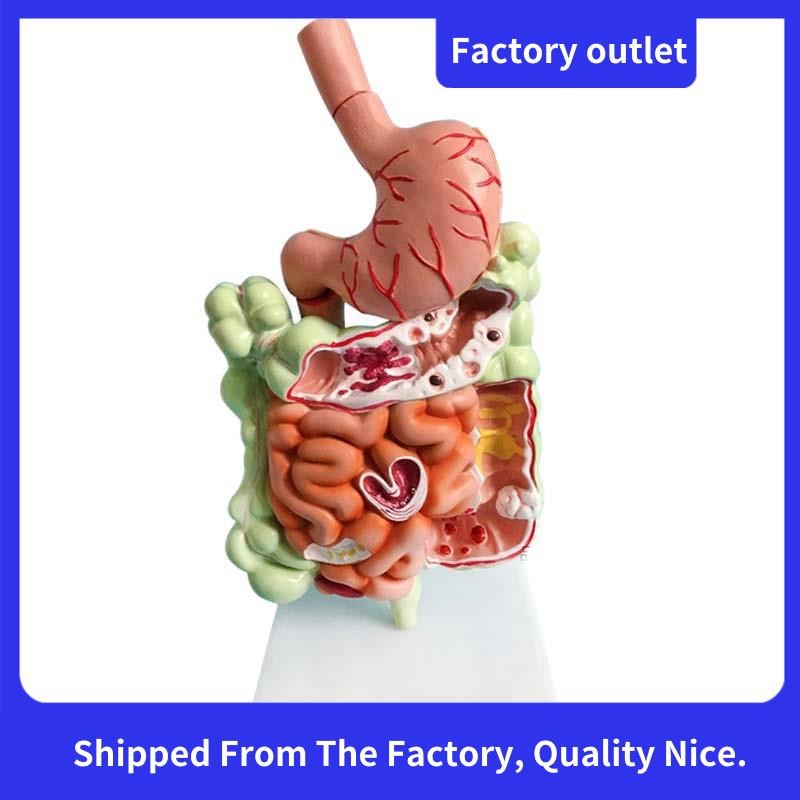Human Digestive System Model Stomach Anatomy Large Intestine Cecum ...
