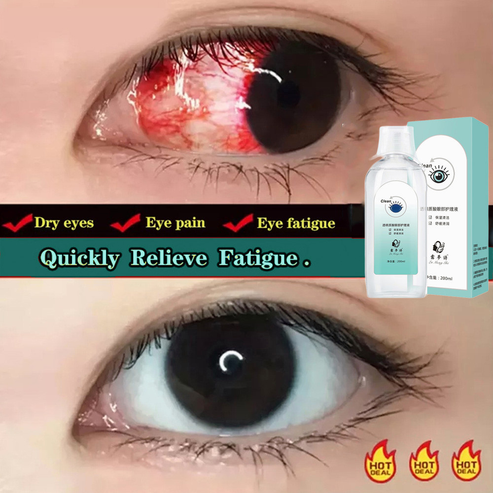 Cataract eye wash and eye care solution clean and moisturize the eyes ...