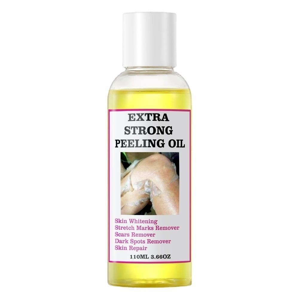 YOUPIN#Yellow Peeling Oil Peeling Oil Peeling Oil Peeling Oil Elbow ...
