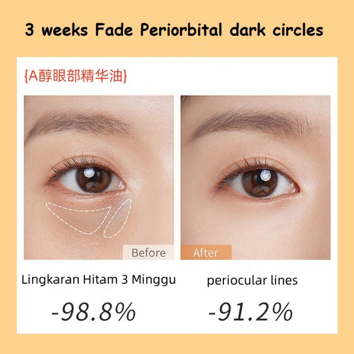 SKIK Eye Essence Oil Rolling Anti wrinkle essence Oil Lightens ...