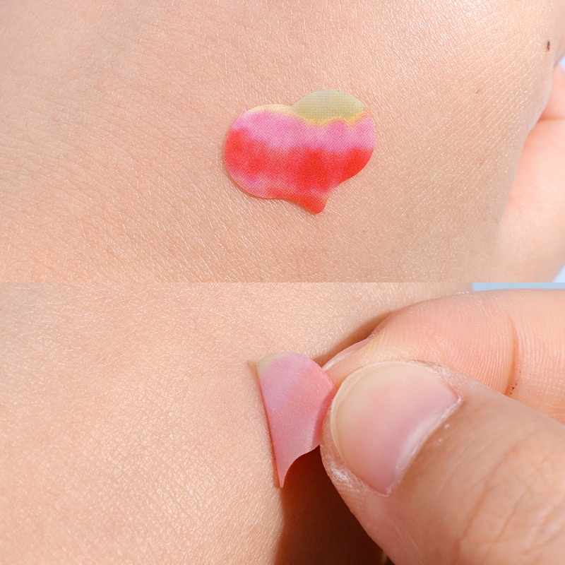 Colorful Love Stars Acne Patch / Breathable Face Spot Stickers / Flower ...