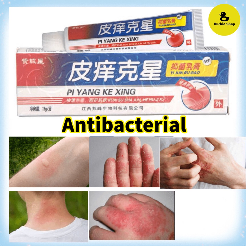 DuckieShop-Eczema Fungus Antibacterial Antiseptic Ringworm Psoriasis ...