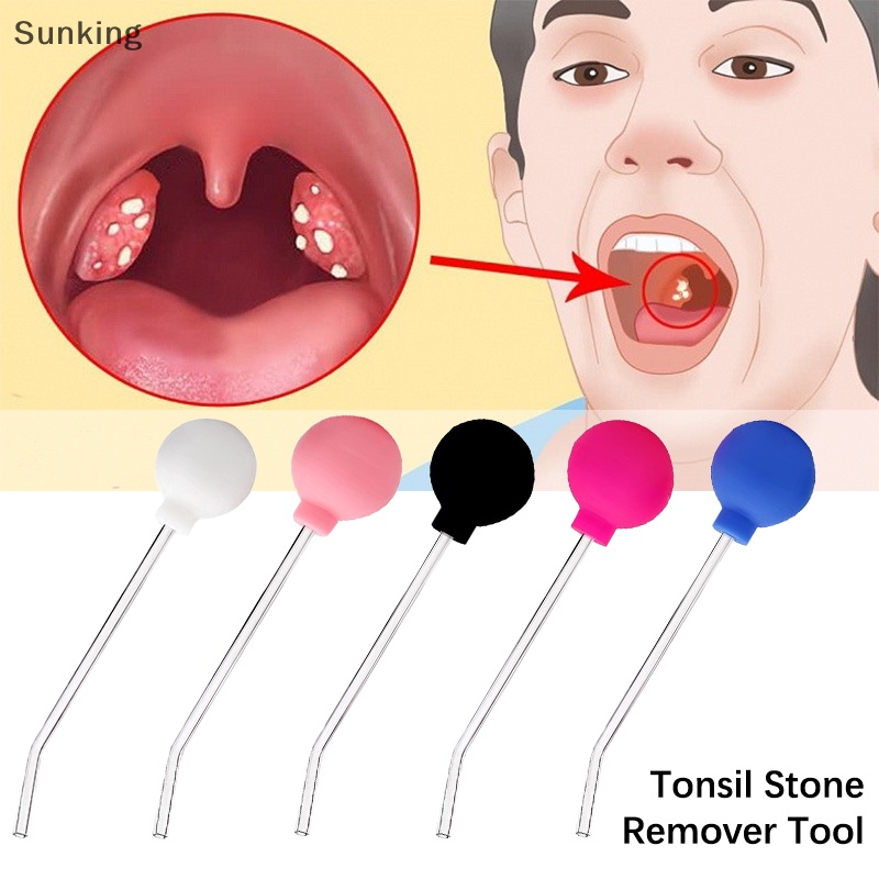 Sunking Tonsil Stone Remover Tool Manual Style Remover Mouth Cleaning ...
