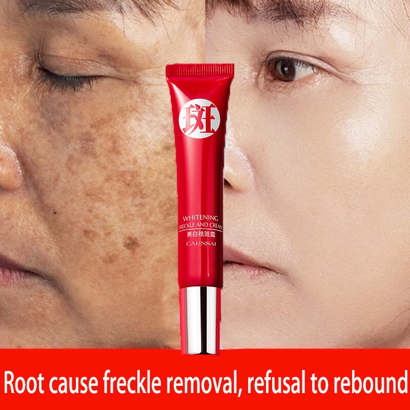 Original Strong Anti-Wrinkle Powerful Lightening Cream Age Removal Dark ...