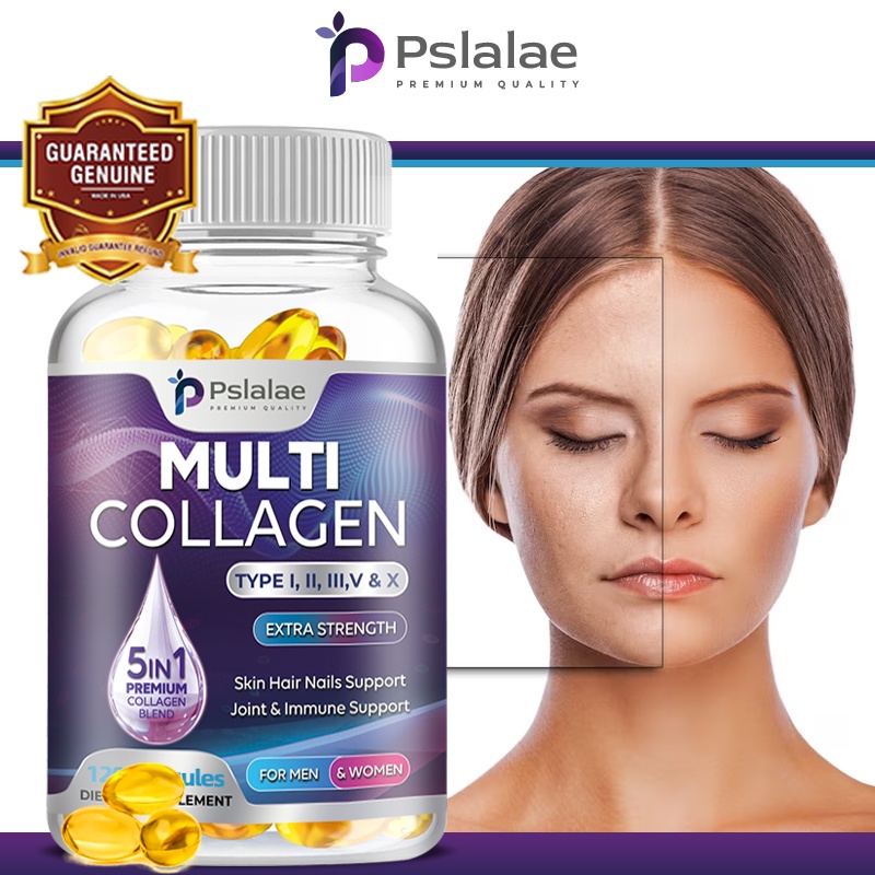 Multi-Collagen Capsules - Advanced Peptide Complex, 5-in-1 Type - Supports Healthy Skin, Hair ...
