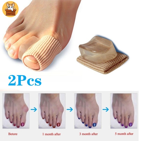 【Am-az】Orthopaedic surgery toe bursitis foot nursing foot therapy ...