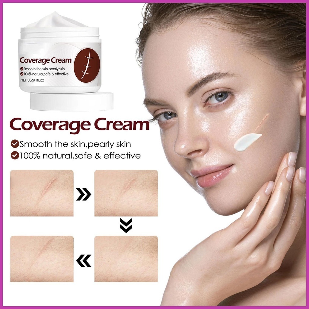 Scar Cream for Old Scars 30g Effective Burn Scar Cream Healing Scar ...
