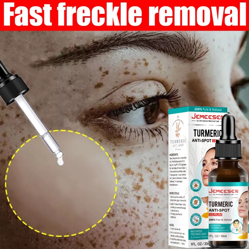 Jemeesen Turmeric Freckle Witening Surem Dark Spot Remover Remove ...