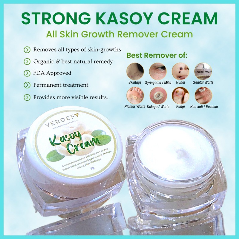 Kasoy Cream Removing warts and moles cream | Shopee Malaysia