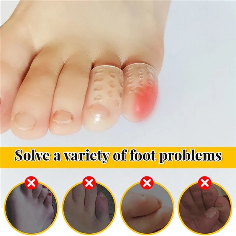 5/10/20pcs Finger Toe Protector - Pain Relief Preventing Blisters Corns ...