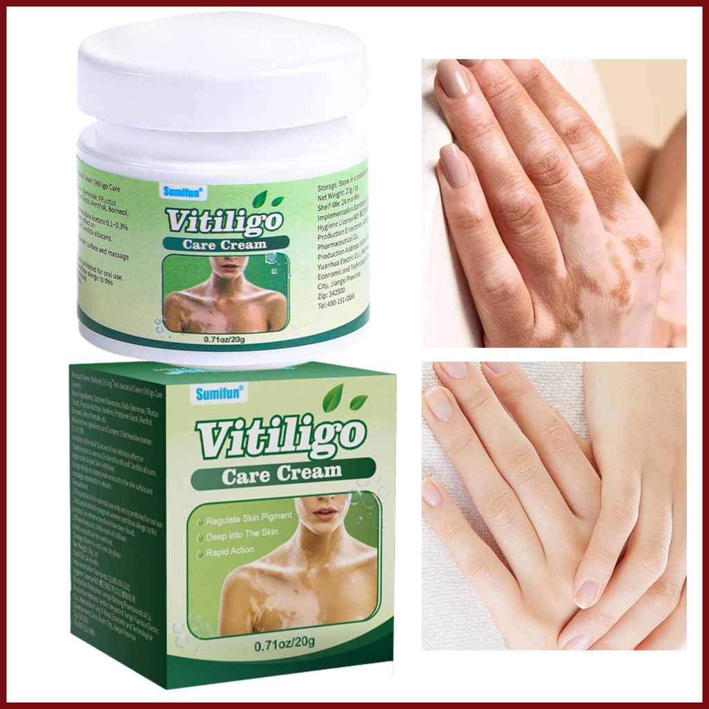 White Spot Removal Cream Body Care Ointment Natural Repair Ointment ...