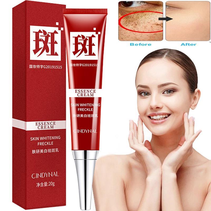 Whitening and freckle removing cream Moisturizing Fade freckle Essence ...