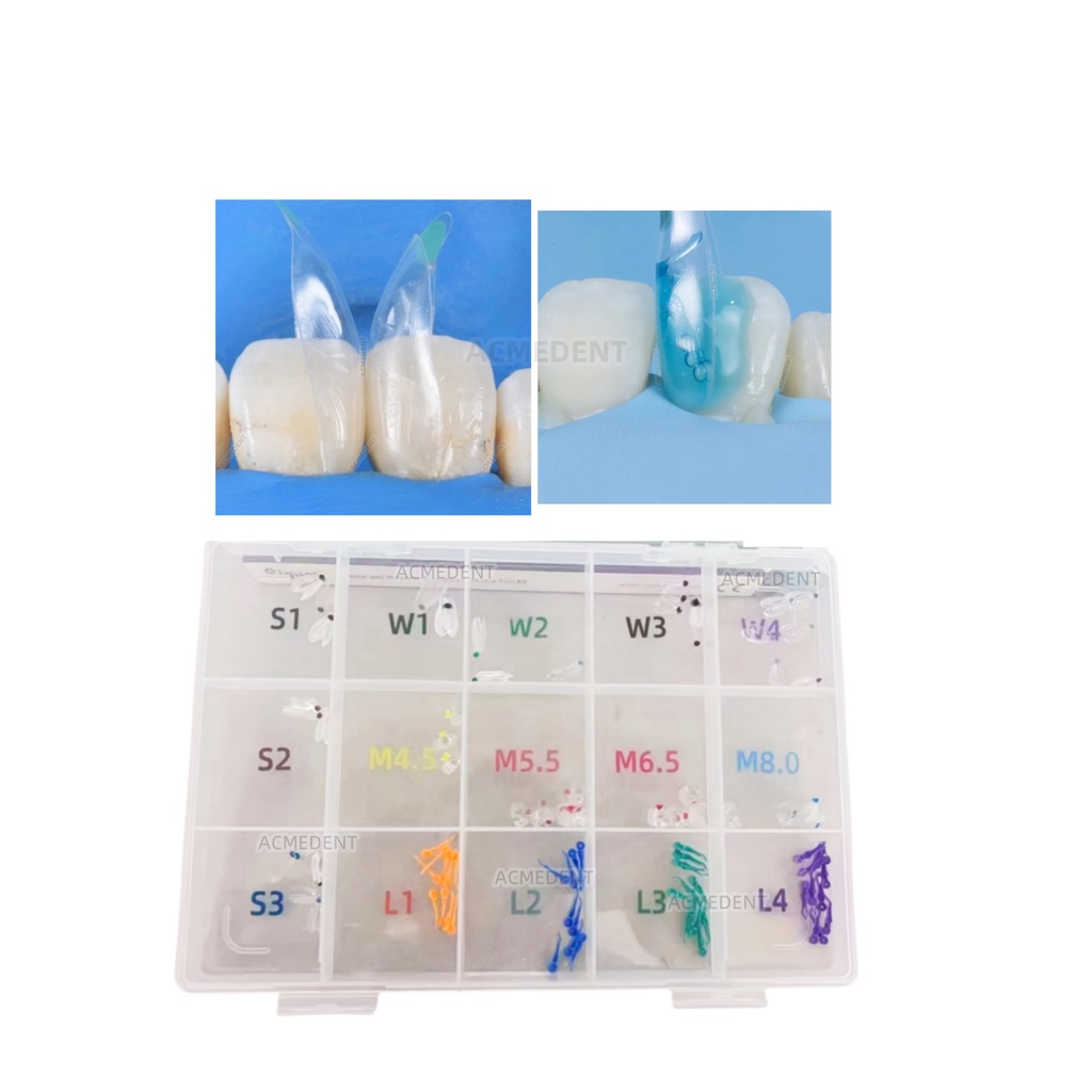 Clear Matrix Dental BT Matrices Black Triangle Wedges Diastema ...