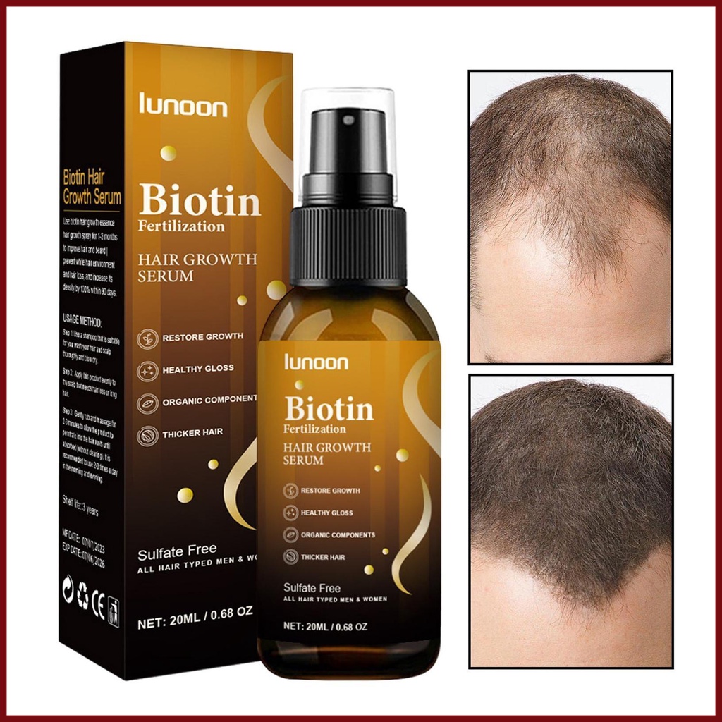 Biotin Hair Thickener Hair Regrowth Serums 20ml Biotin Hair Loss Oil Nourishing Hair Regrowth ...