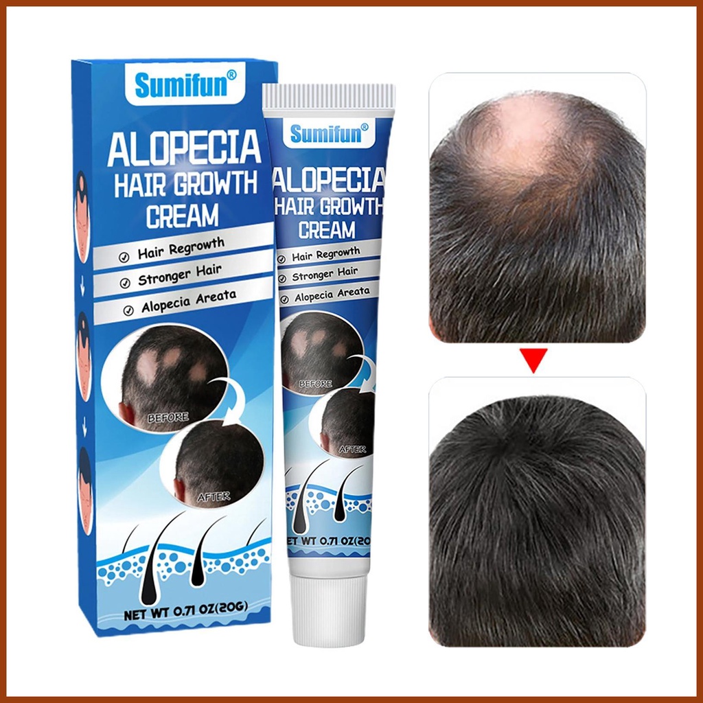 Baldness Cream 20g Dense Hair Beauty Hair Care Anti Alopecia Fast Hair ...