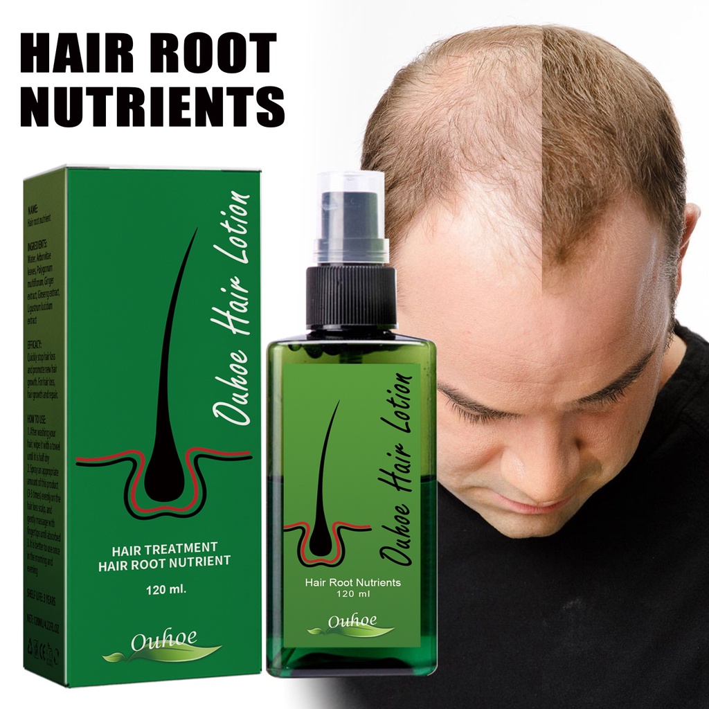 Ouhoe Ginger Hair Growth Spray 100ml Herbal Hair Serum Treat Hair Loss ...