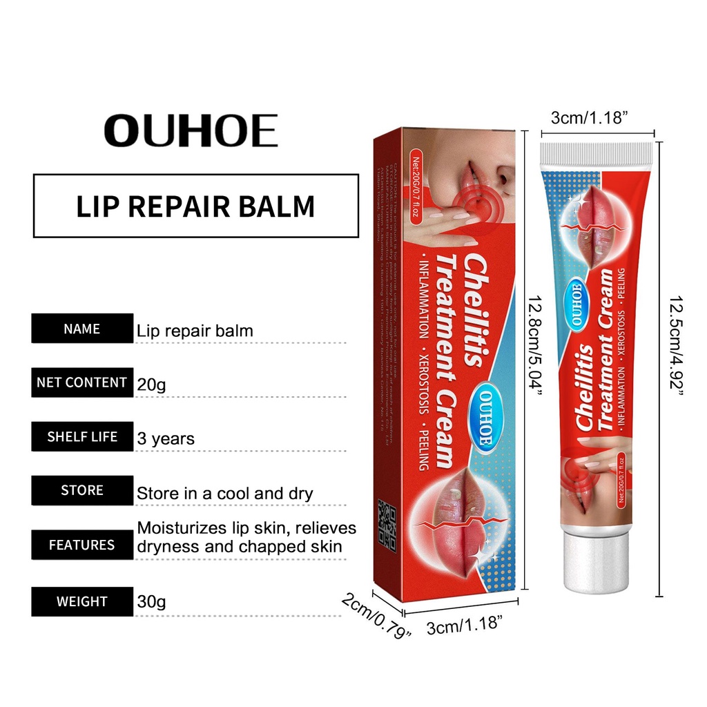 OUHOE Cheilitis Treatment Cream 20g Labial Herpes Antibacterial Ointment Chapped Peeling ...