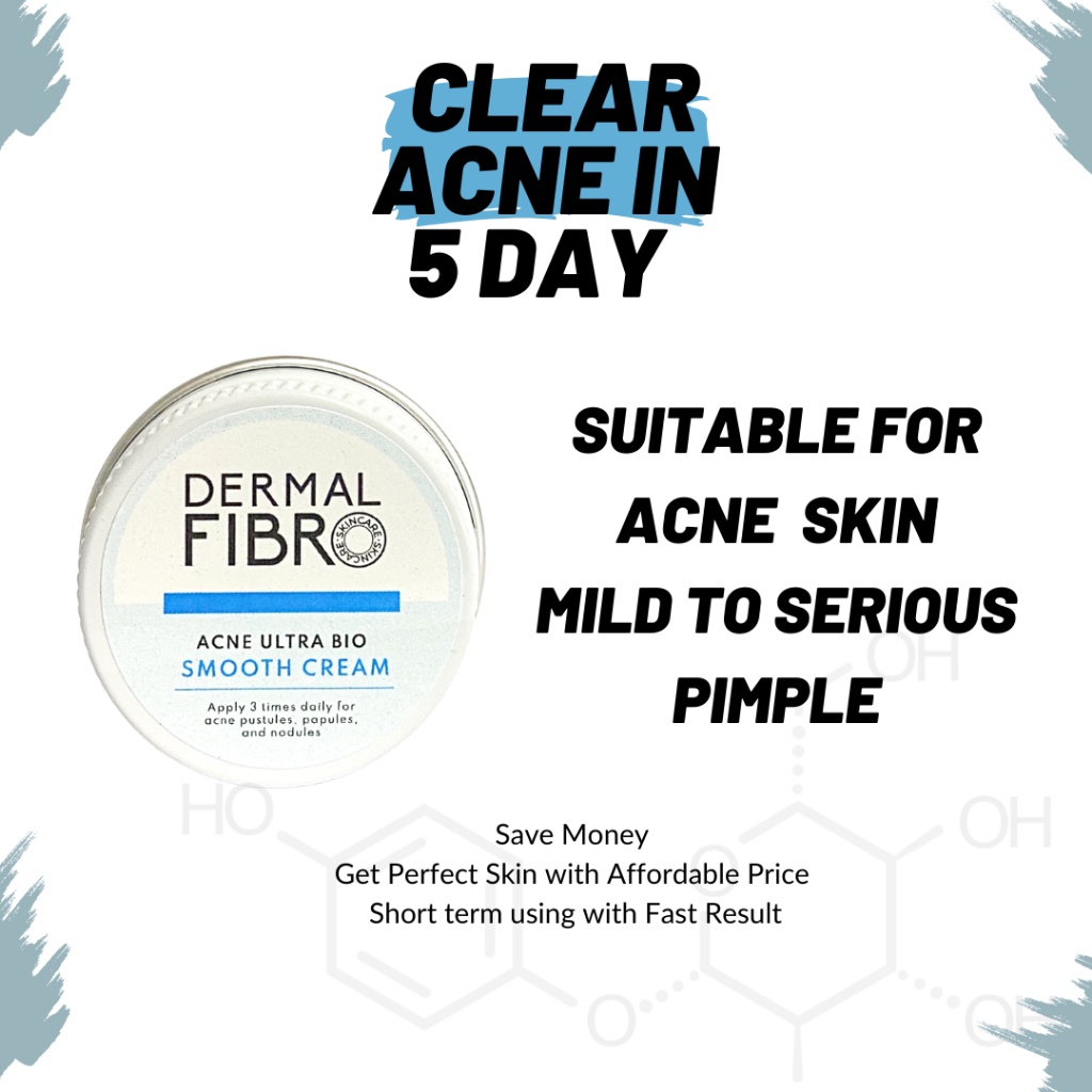 Anti Acne Ultra Fast Cream Krim Jerawat Fast Action Buang Kuman Degil ...