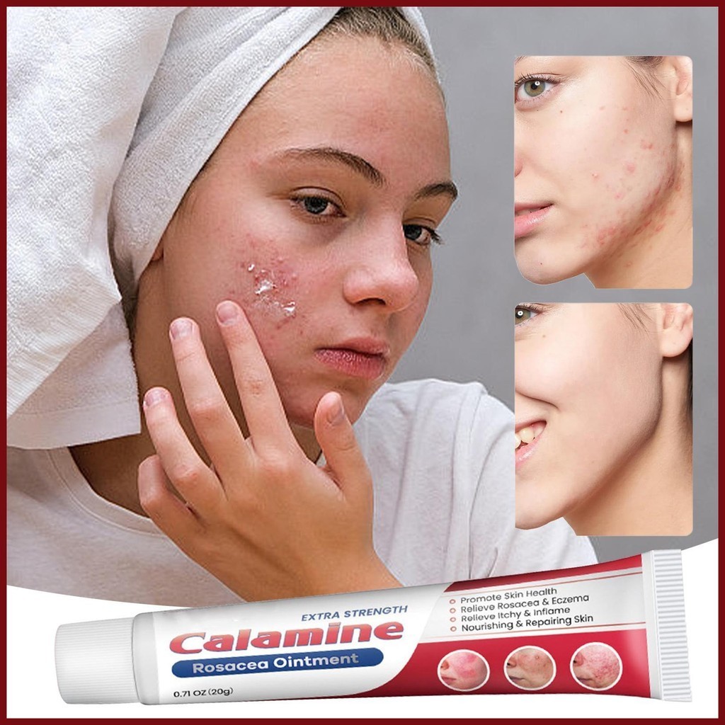Dark Mark Relief Cream Skin Redness Ointment Rapid Repair Of Pimple ...