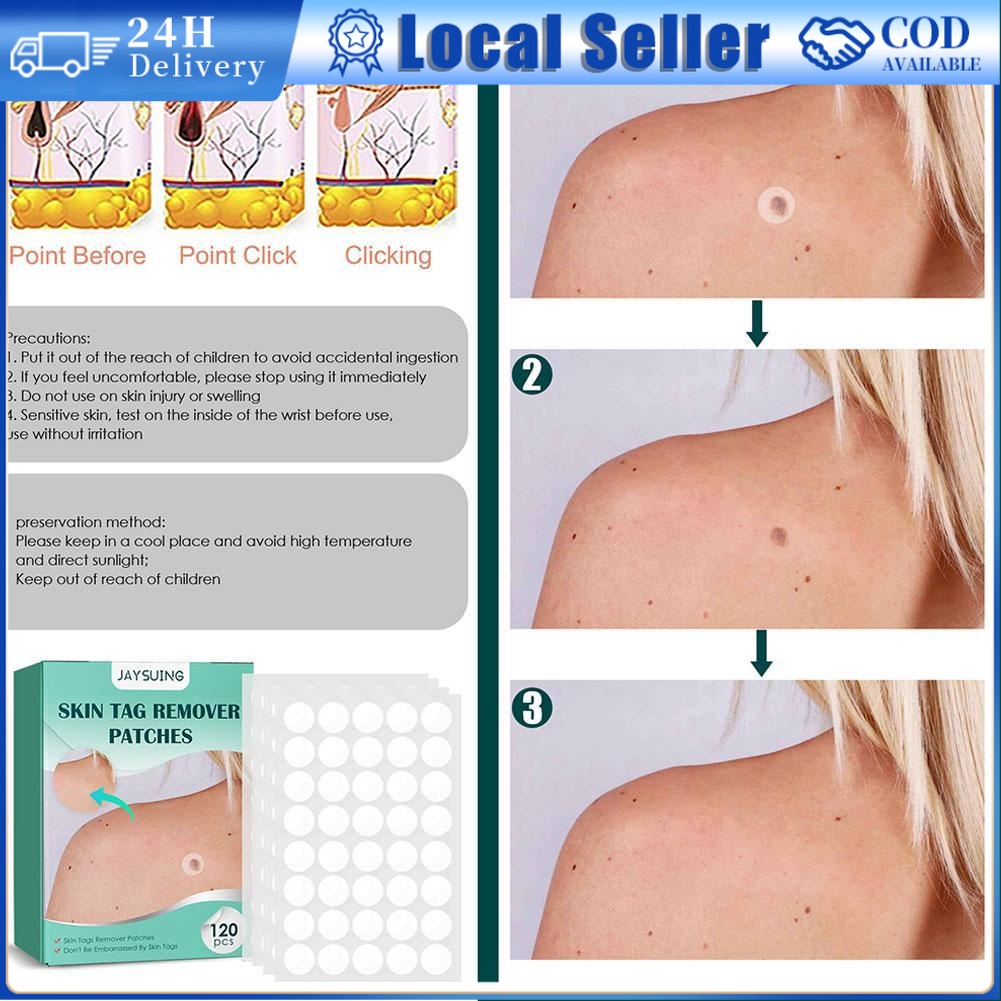 120Pcs Skin Tag Remover Patch Pimple Wart Treatment Quick Absorb ...