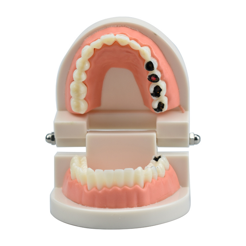 Teeth Model Teaching Study Demonstration Tooth Model Standard Dental ...