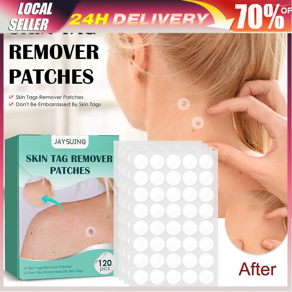 120pcs skin tag remover patch mole wart remover acne patch Skin ...