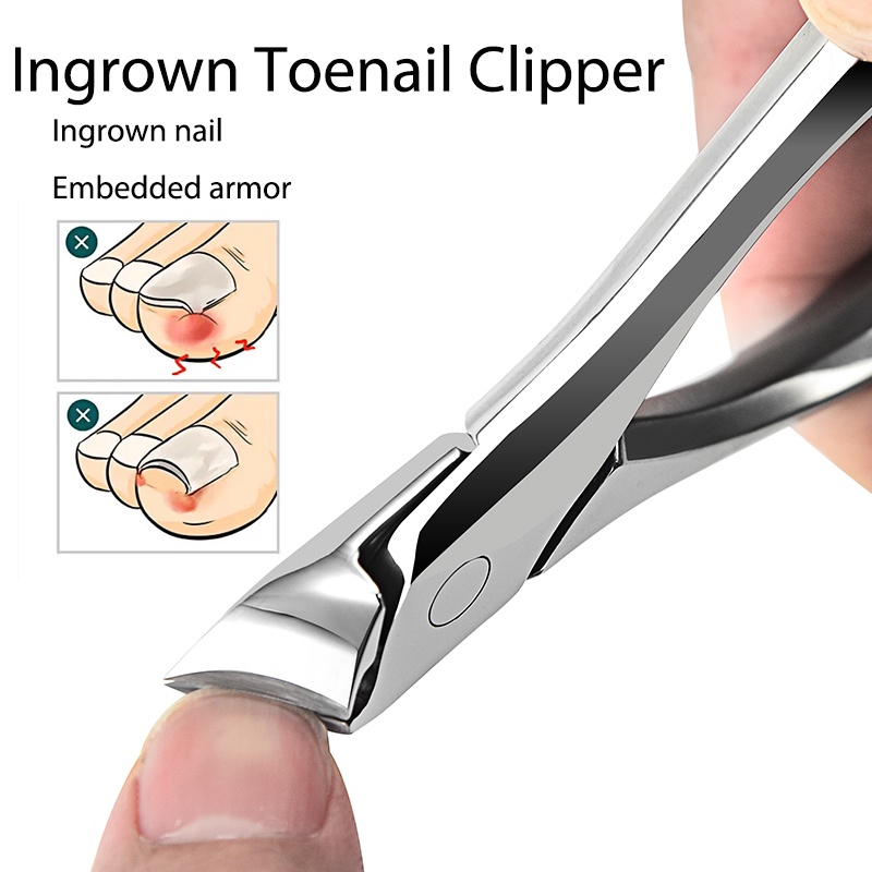 Thick Toenails Cutter Trimmer Stainless Steel Nail Clippers Ingrown ...