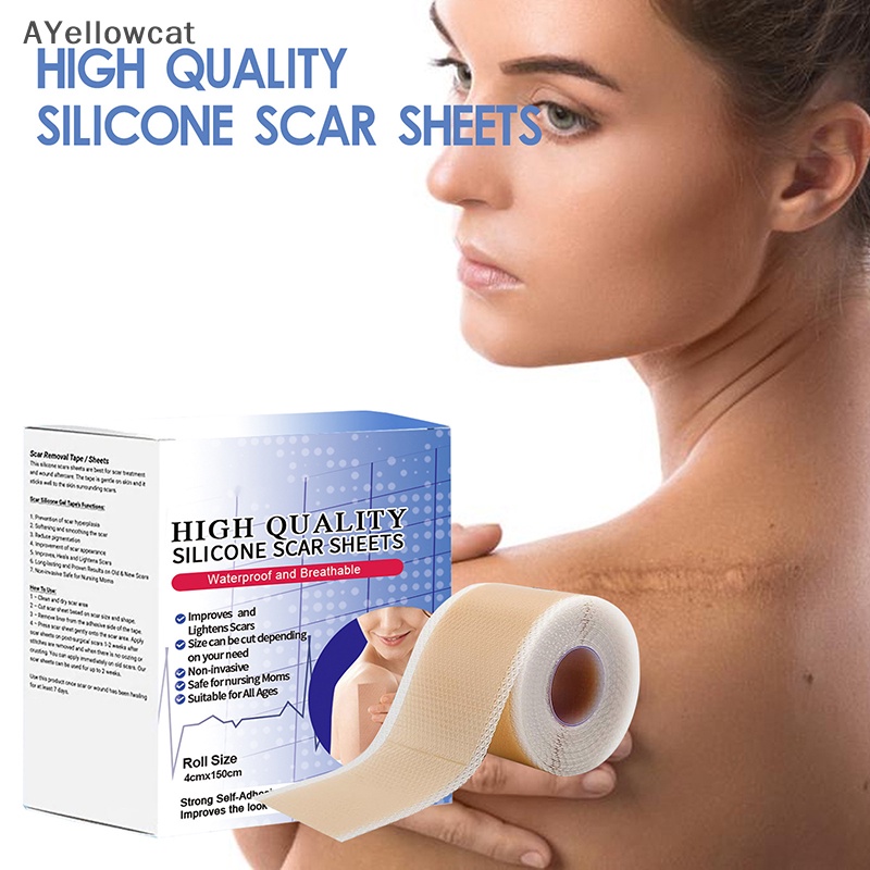 AY Silicone Scar Sheets Patch Painless Scar Repair Tape Roll Effective ...
