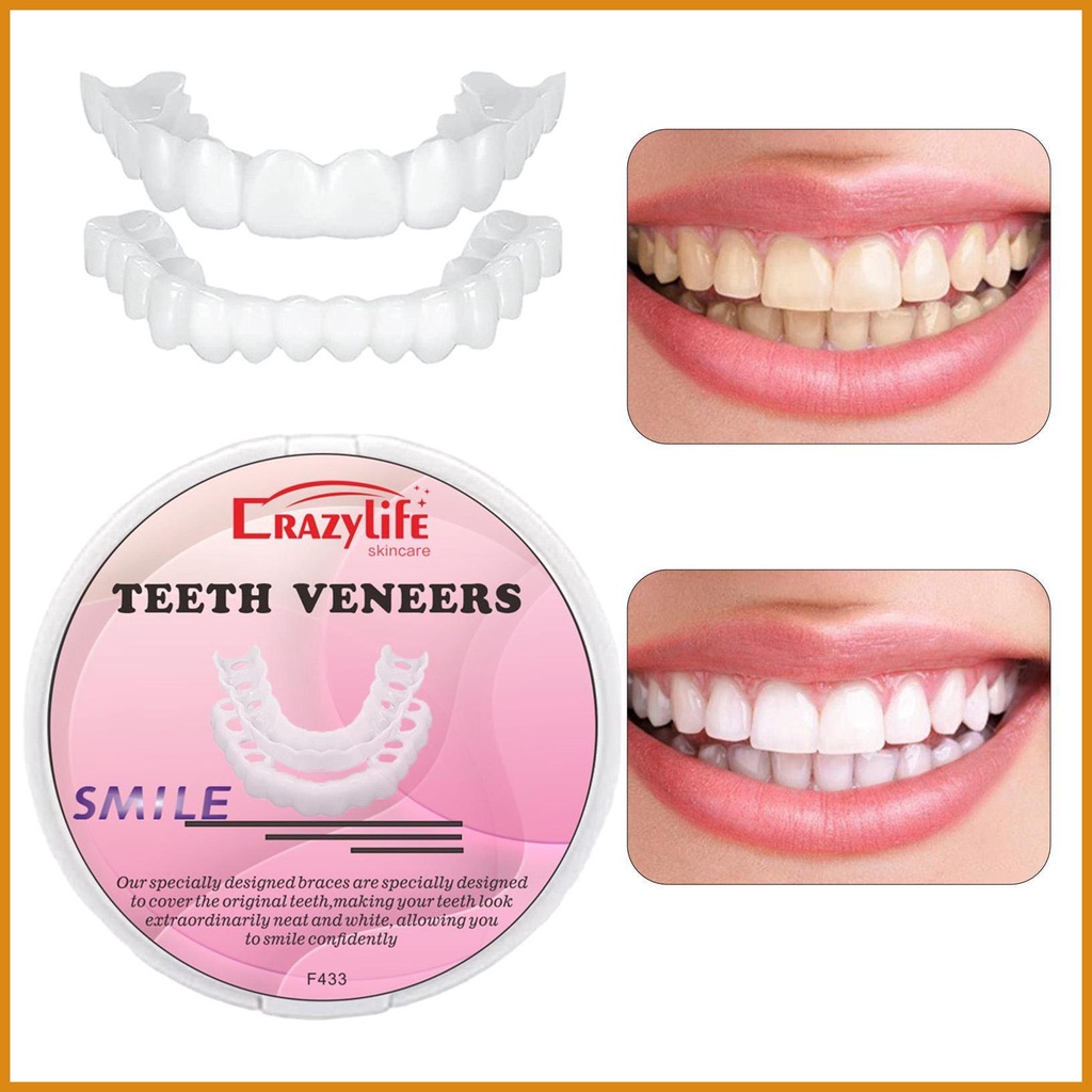 Snap On Smile Denture /Teeth Veneers 1set Top And Bottom - Silicone ...